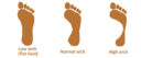 Arches of the foot – Ferebres Shoe Search
