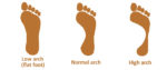 Arches of the foot – Ferebres Shoe Search